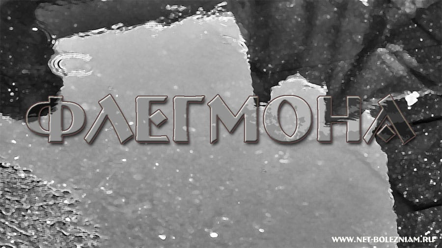 Флегмона: виды, симптомы и лечение — Net-Bolezniam.Ru